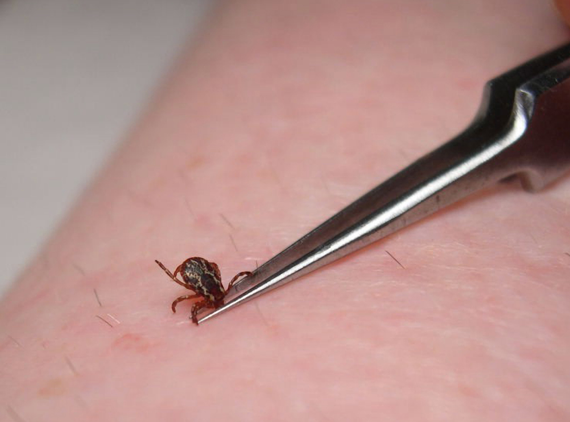 Ticks The Plague Of Summer The Forum Newsgroup